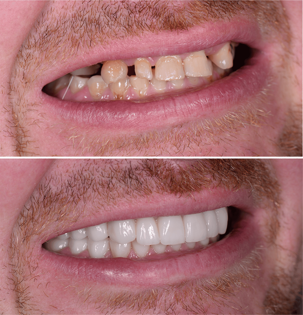 Services | Pure Smiles